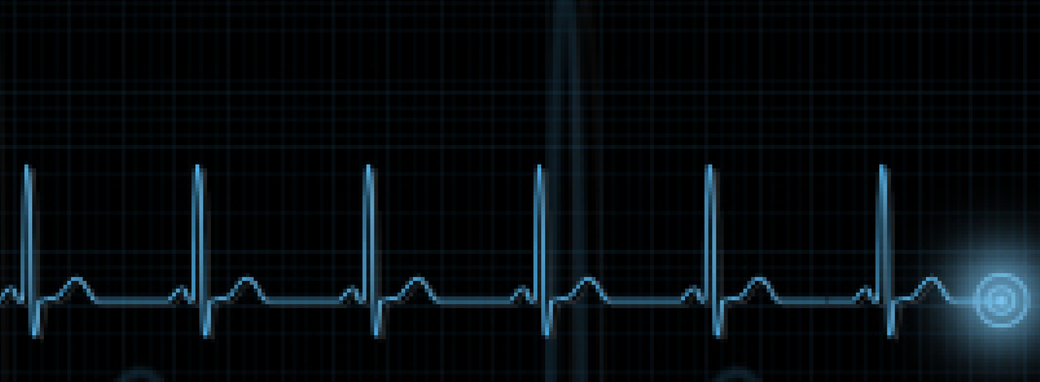 Hand Over Heart EKG | Digital Wireless ECG | Stream ECG Wirelessly